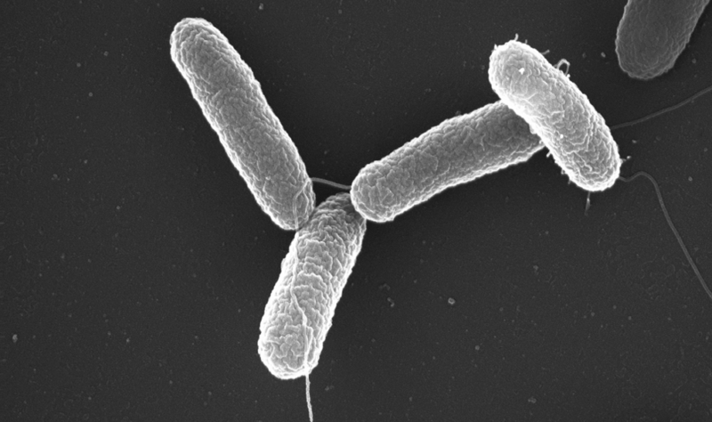 Qu'est ce que la salmonellose ? - Maladies infectieuses, Nutrition ...