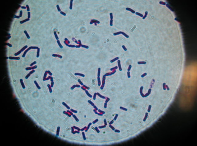 Quel traitement pour Bacillus Cereus ? - Maladies infectieuses