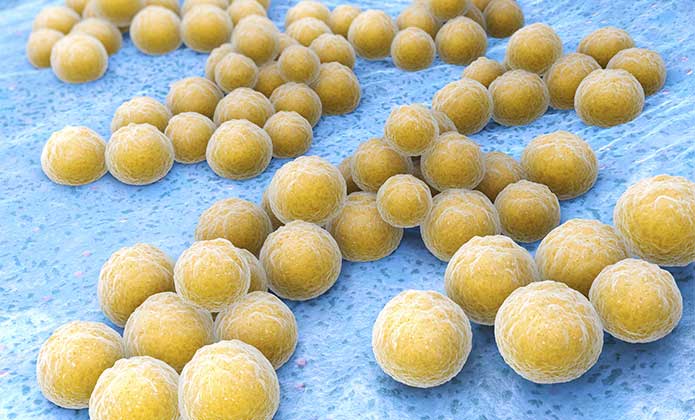 Qu'est ce qu'un furoncle ? - Maladies de peau